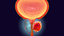 Subset of Men With Rare Prostate Cancer May Benefit From Immunotherapy ...