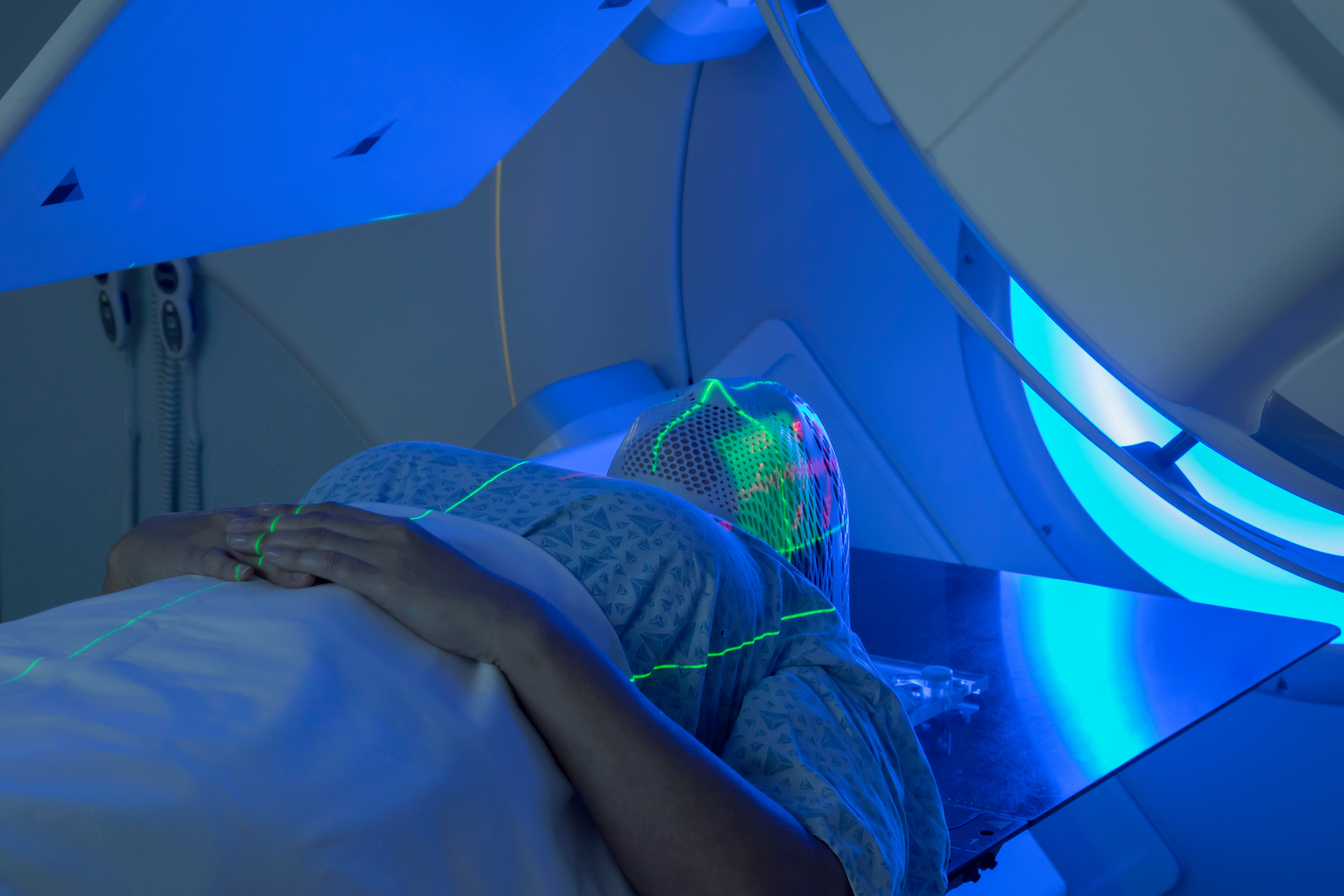 Response-Adapted Radiation Therapy for Orbital Indolent B-Cell Lymphoma ...