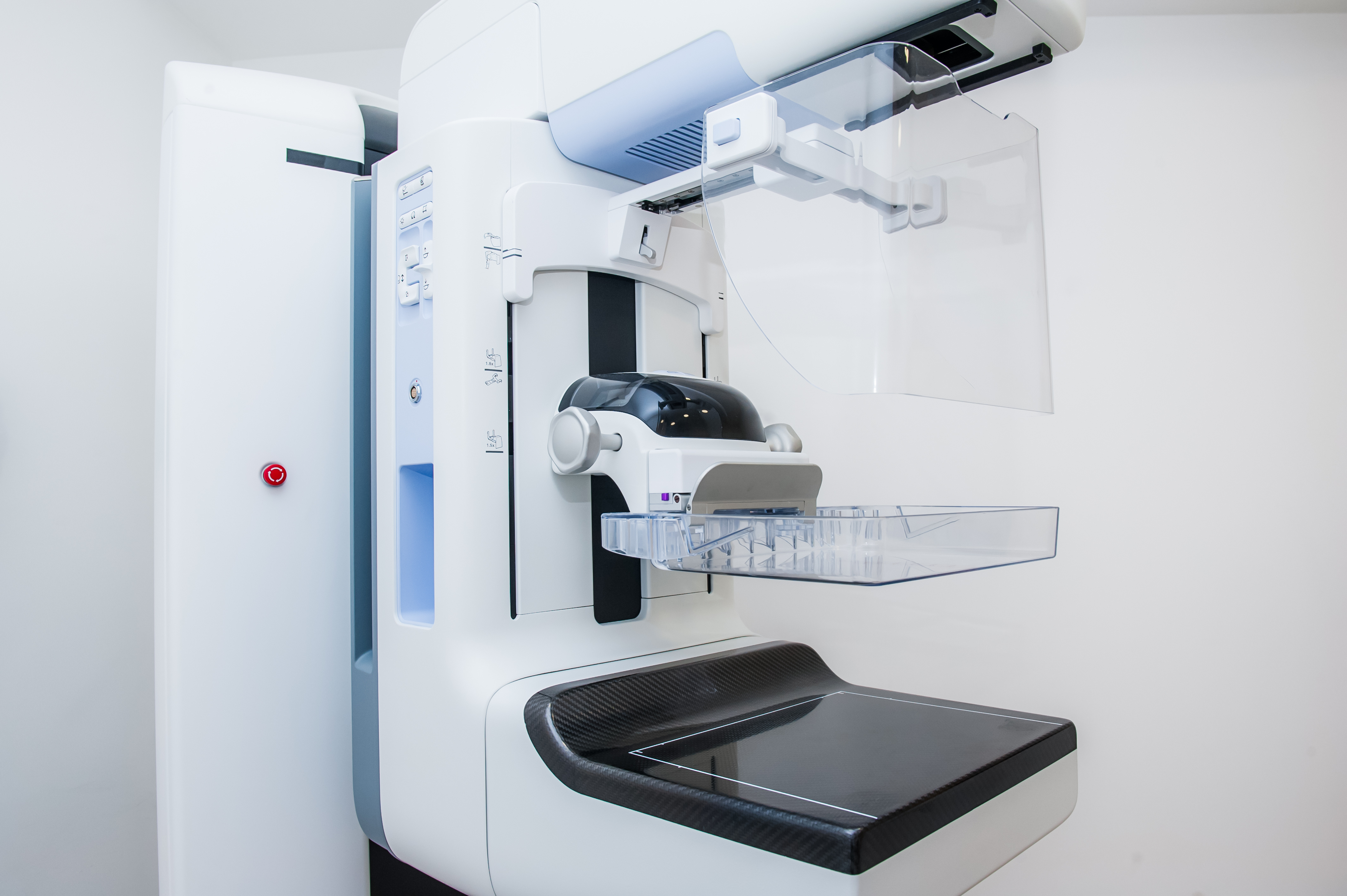 Patient Support Found for AI Use as Second Reader of Mammograms - The ...