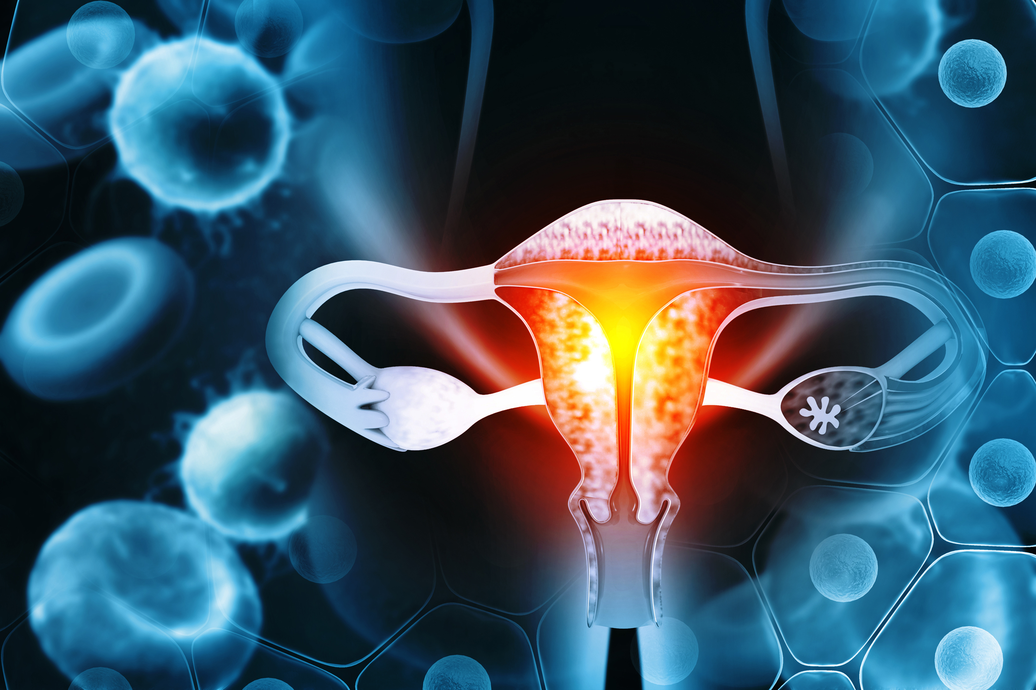 Short- vs Standard-Course Radiation Therapy for Endometrial Cancer ...