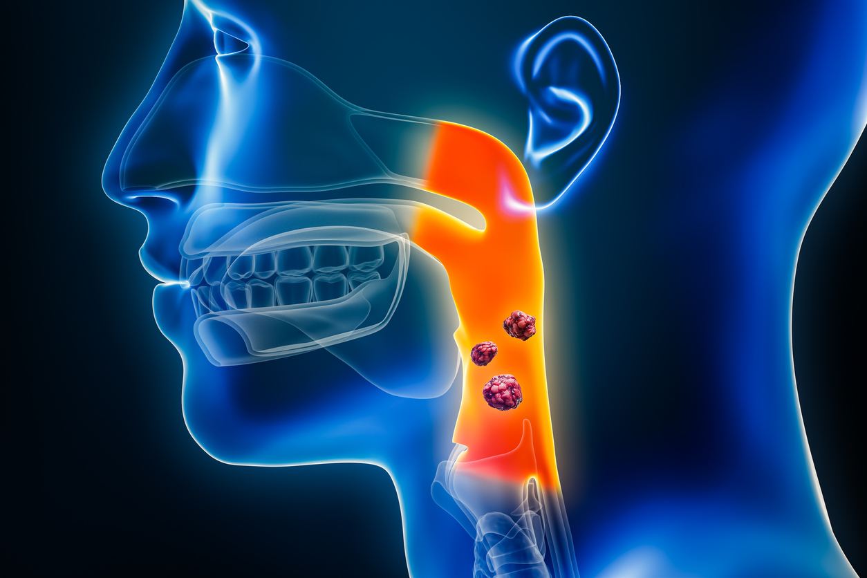 Addition of Neoadjuvant Adjuvant Pembrolizumab Significantly Improves ...