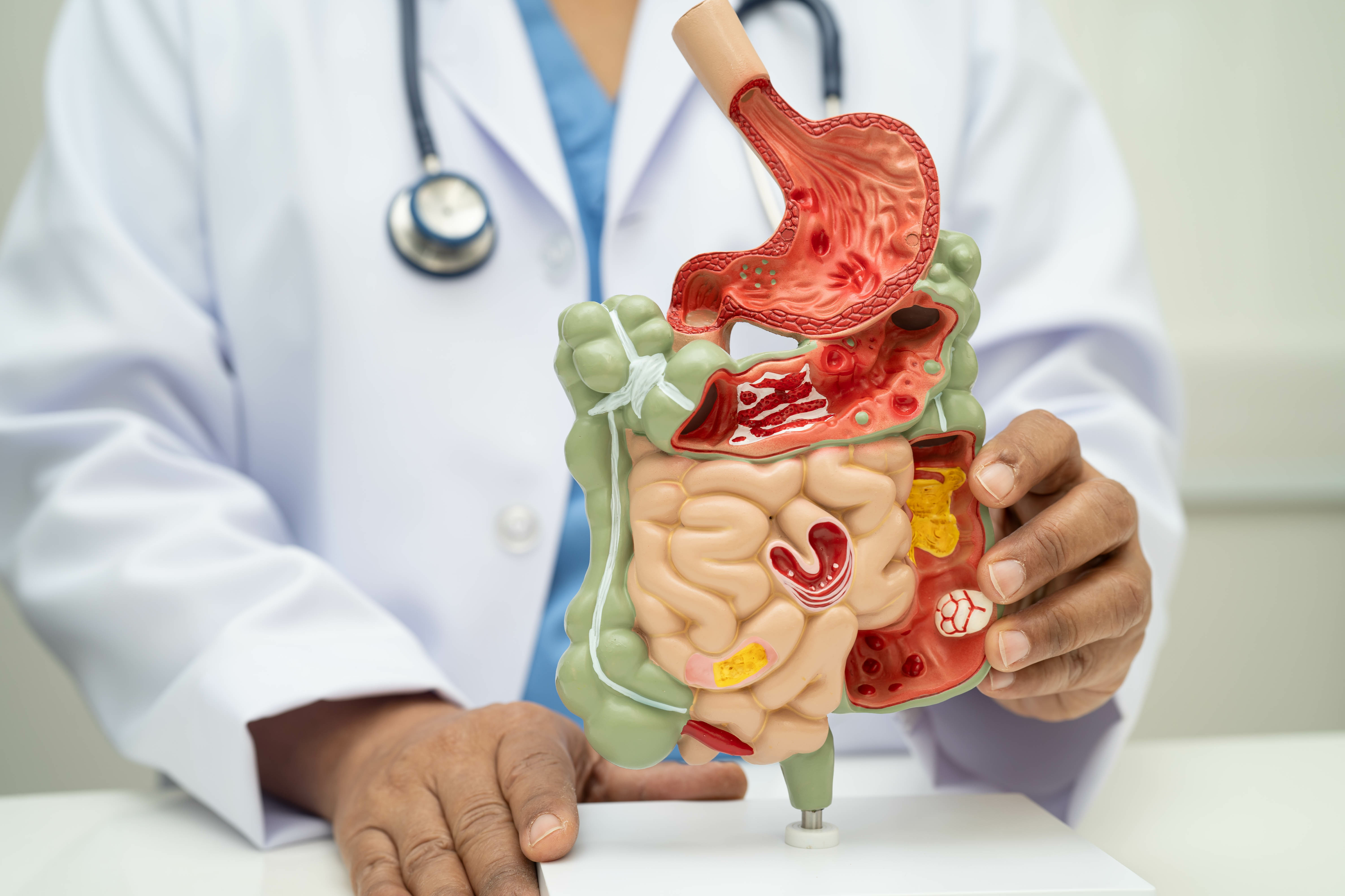 Can Autoimmune Diseases Increase the Risk of Digestive System Cancer ...
